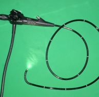 Fibroscopie bronchique | Pratique.fr